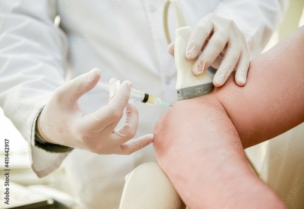 Ultrasound-guided platelet-rich plasma injection of the elbow Stock ...