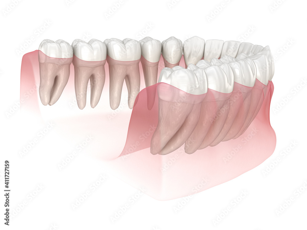 Morphology of human teeth. Medically accurate tooth 3D illustration ...