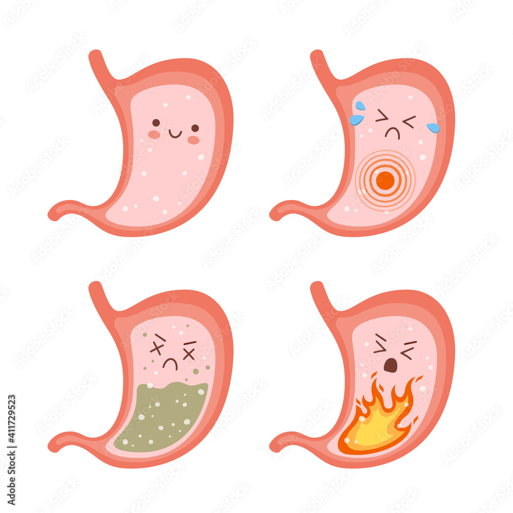 Healthy stomach and sick stomach characters. Gastritis, indigestion ...