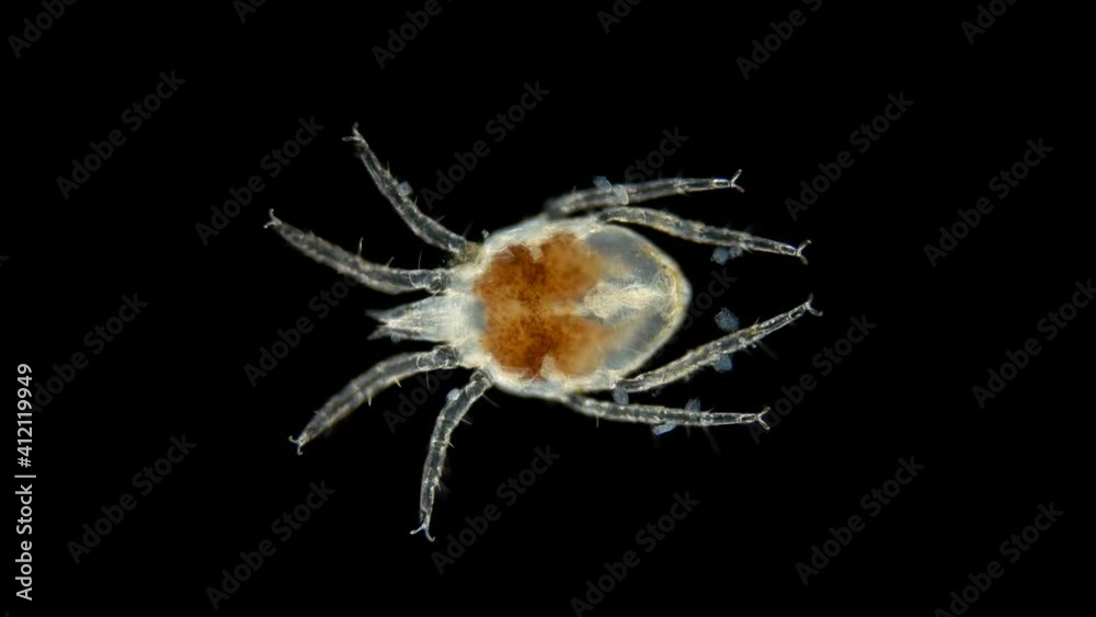 Acari(mite) living in water under a microscope, the superfamily ...