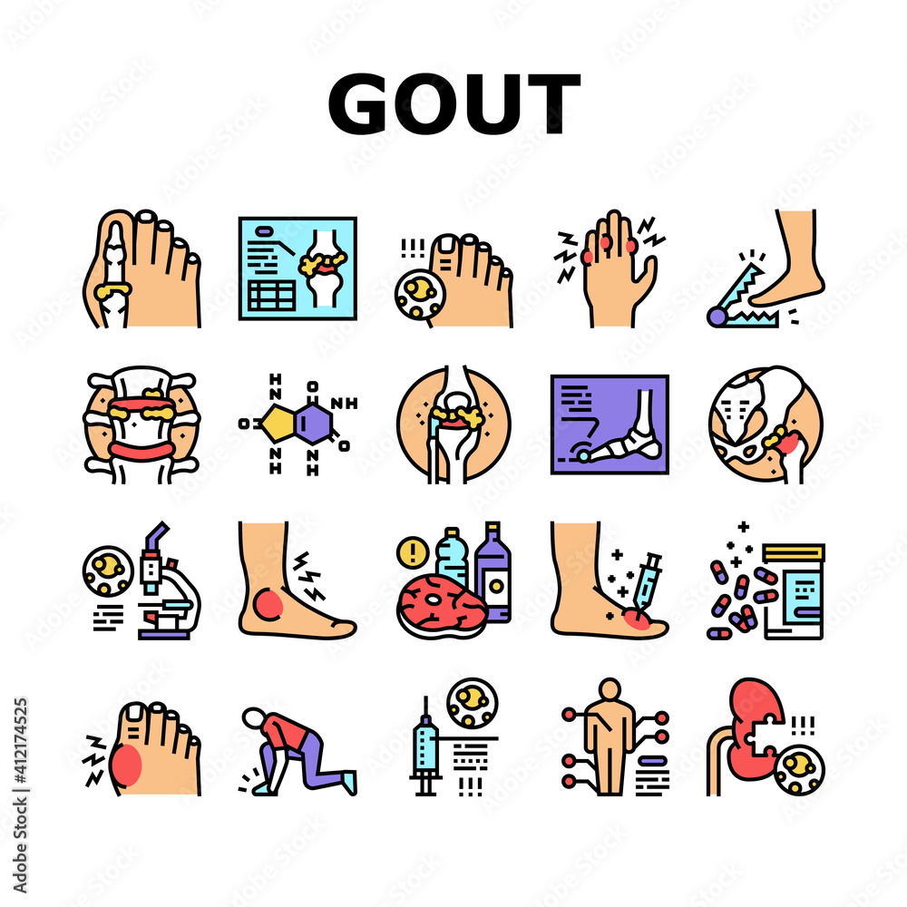 Gout Health Disease Collection Icons Set Vector. Ridge And Articular ...