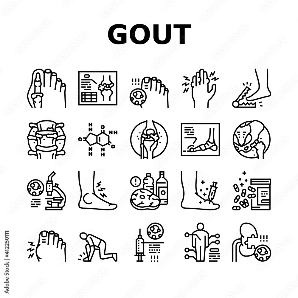 Gout Health Disease Collection Icons Set Vector. Ridge And Articular ...