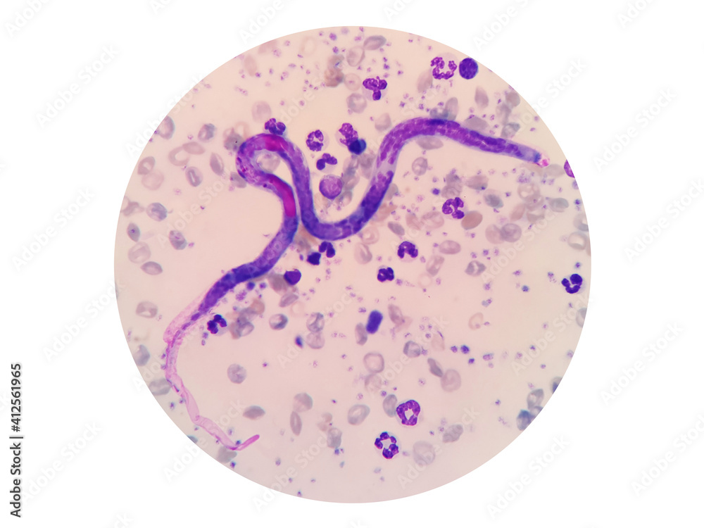 Microfilariae are sheathed in the blood smear of a dog. Light ...