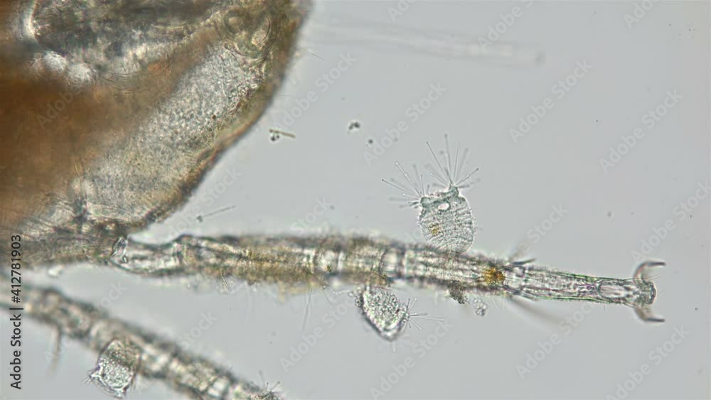 Colony of ciliates Acineta sp. under the microscope, Suctoria Subclass ...