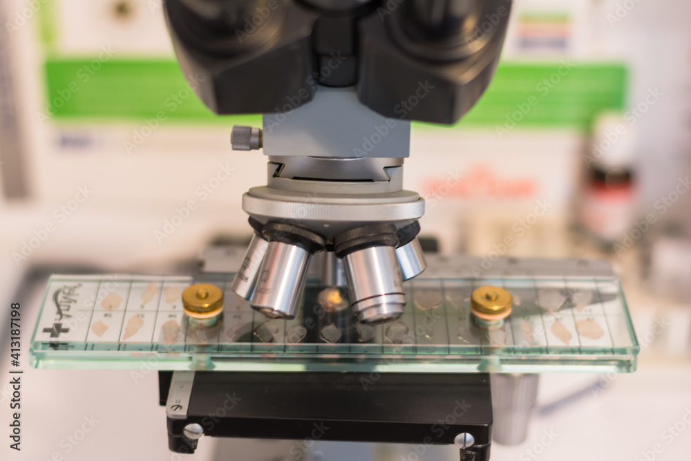 The compression or trichinoscopy method consists in the microscopic ...