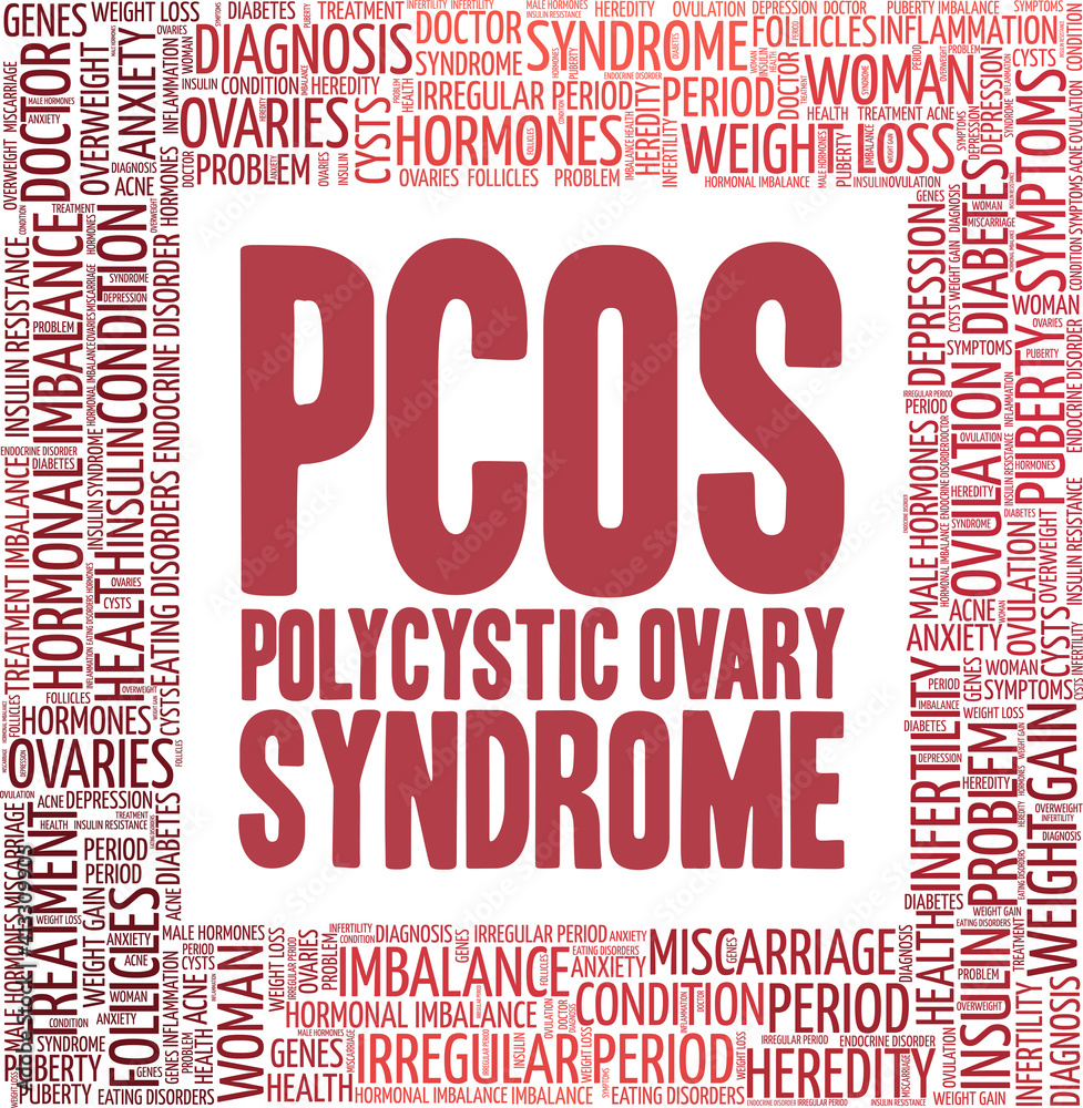 PCOS - Polycystic Ovary Syndrome vector illustration word cloud ...
