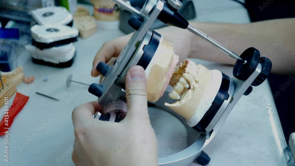 Dentist working with artificial jaw, denture. laboratory worker holding ...
