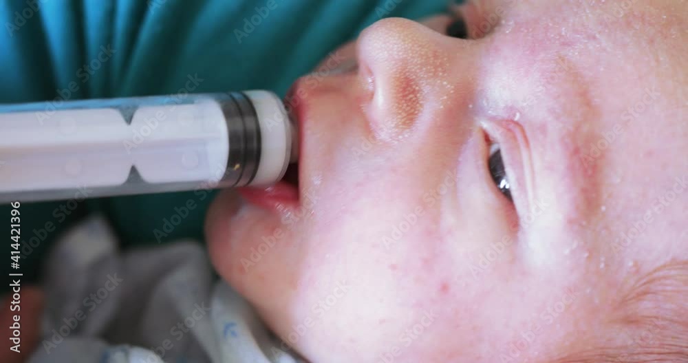 Artificial feeding of the child with a syringe Stock Video | Adobe Stock