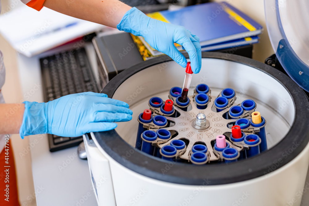 Getting ready. Close up of human hands putting the test tubes to ...