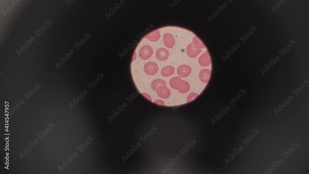 Drop of blood under microscope, vaccine research, medical exam ...