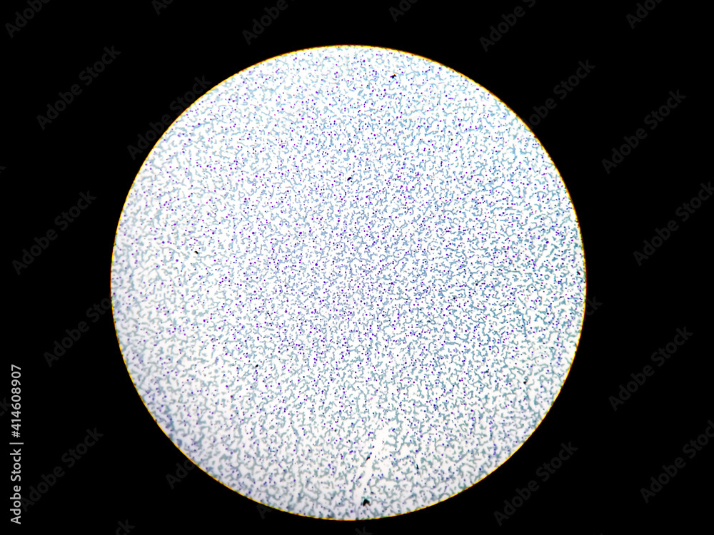 Blood corpuscles. Leucocytes, erythrocytes and platelets.White blood ...