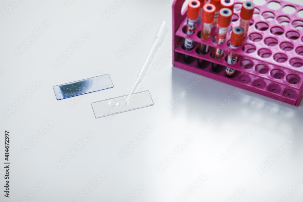 Glass test tubes, blood smear and microscope slide with biomaterial on ...