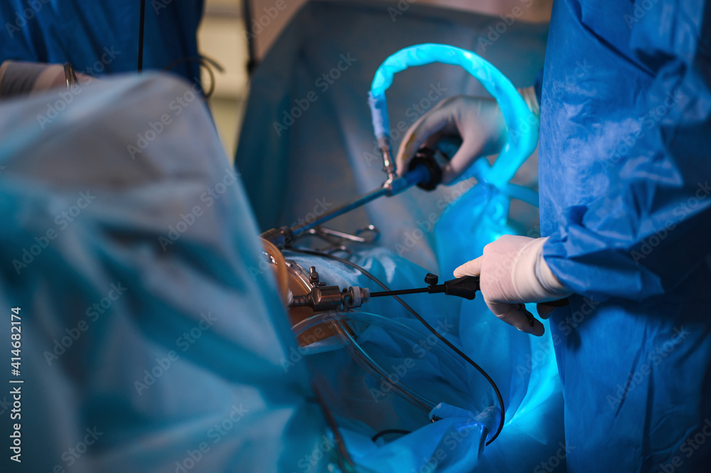Endoscopic surgery to remove the uterus Stock Photo | Adobe Stock