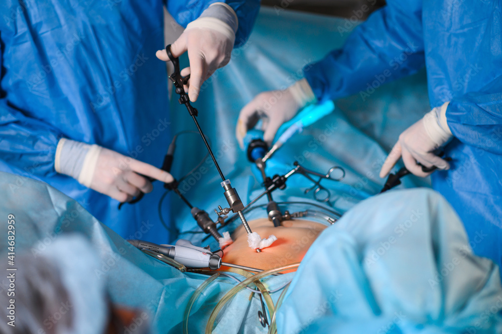 Endoscopic surgery to remove the uterus Stock Photo | Adobe Stock