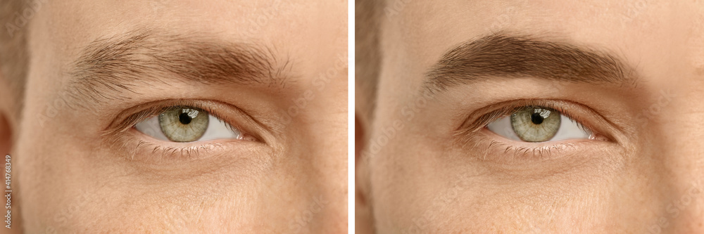 Collage with photos of man before and after eyebrow modeling, closeup ...