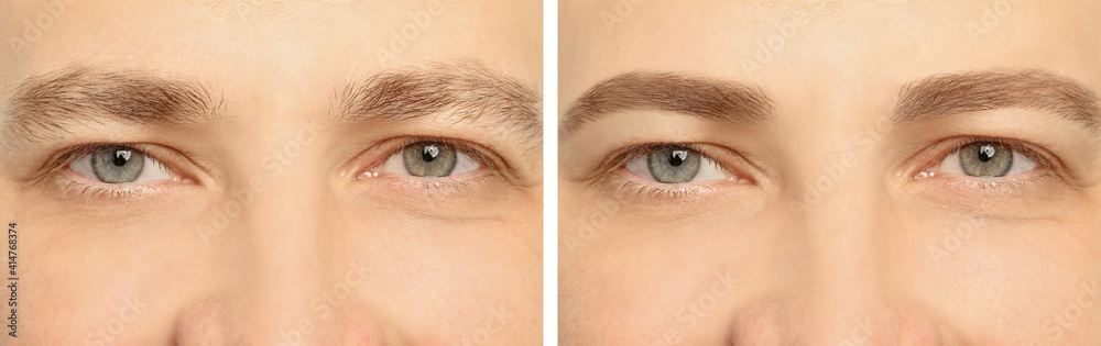 Collage with photos of man before and after eyebrow modeling, closeup ...