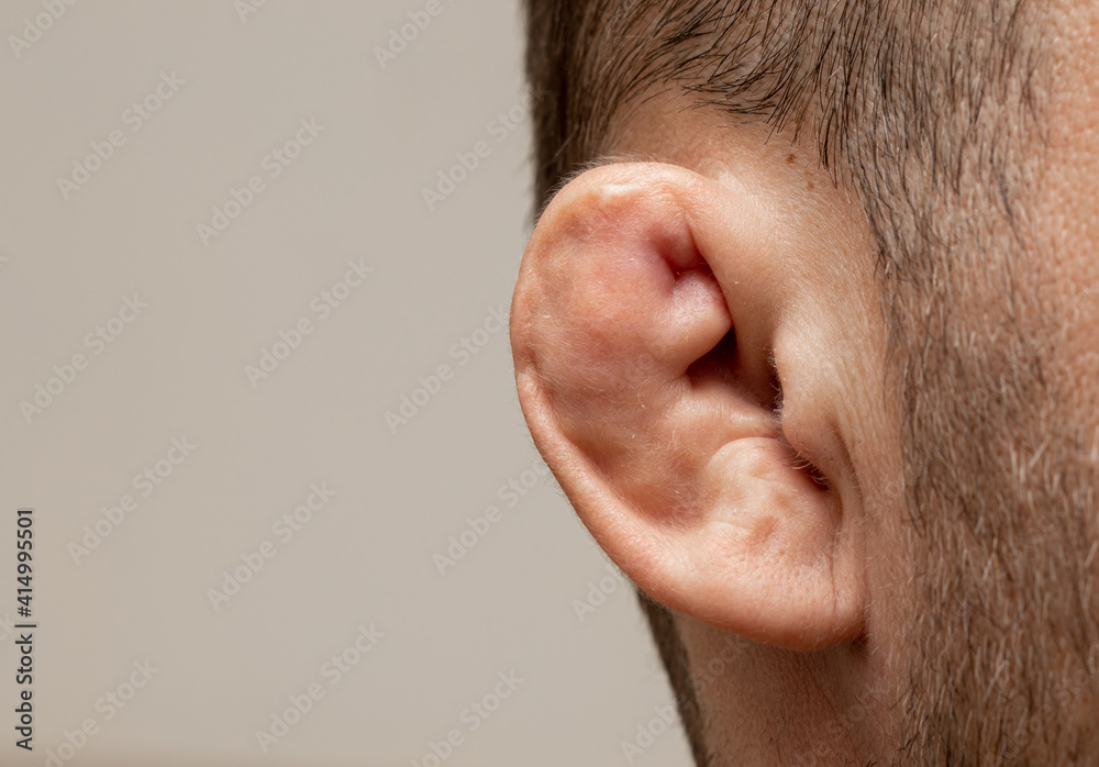 Photography of anatomy of the defective ear. Stock Photo | Adobe Stock