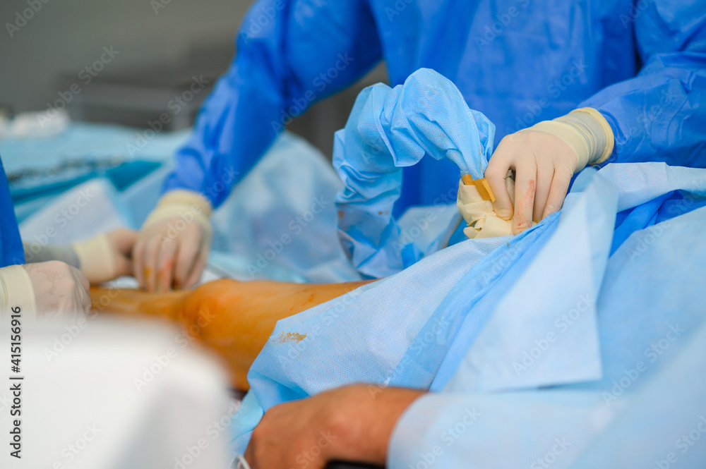 Preparing the patient for phlebectomy surgery. Surgical field marking ...