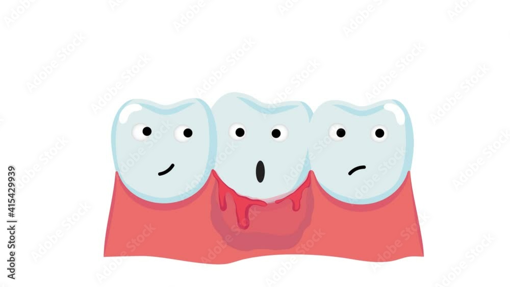 Flat vector animation for dentistry. The teeth of the characters show ...