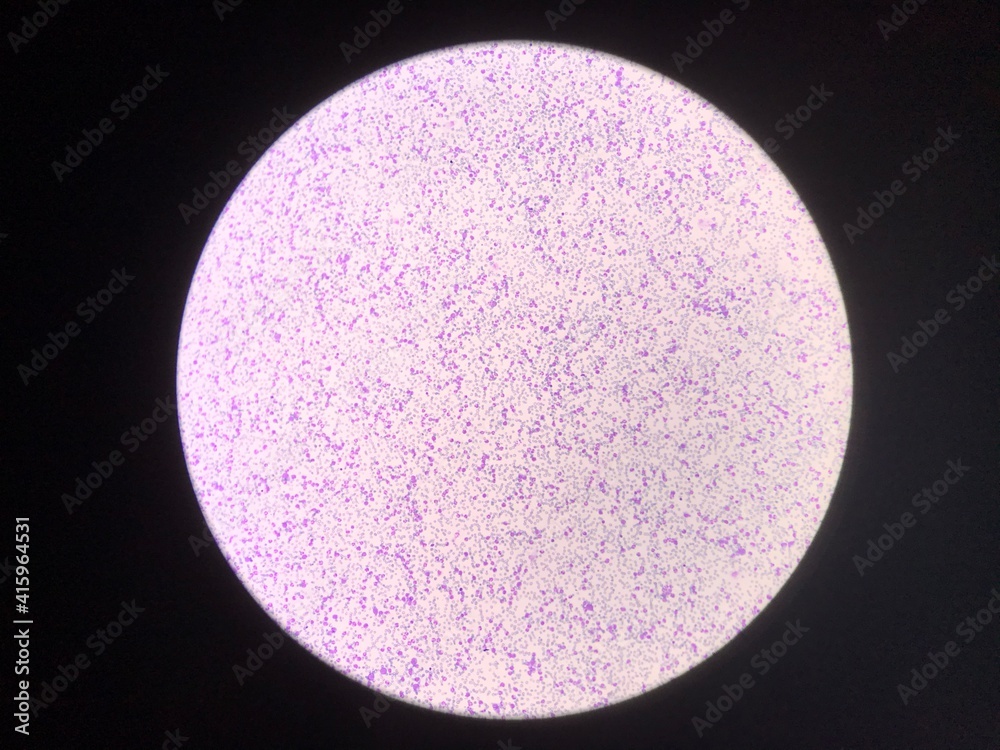 Immature and mature white blood cells.Segmented neutrophil,blast cells ...