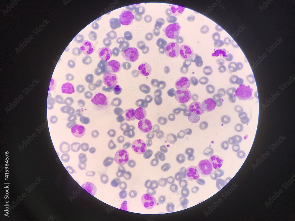 Immature and mature white blood cells.Segmented neutrophil,blast cells ...