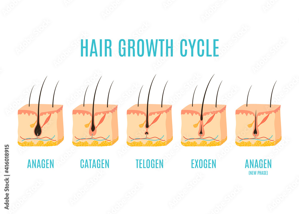 Hair growth cycle medical educational poster. Skin ross-section showing ...