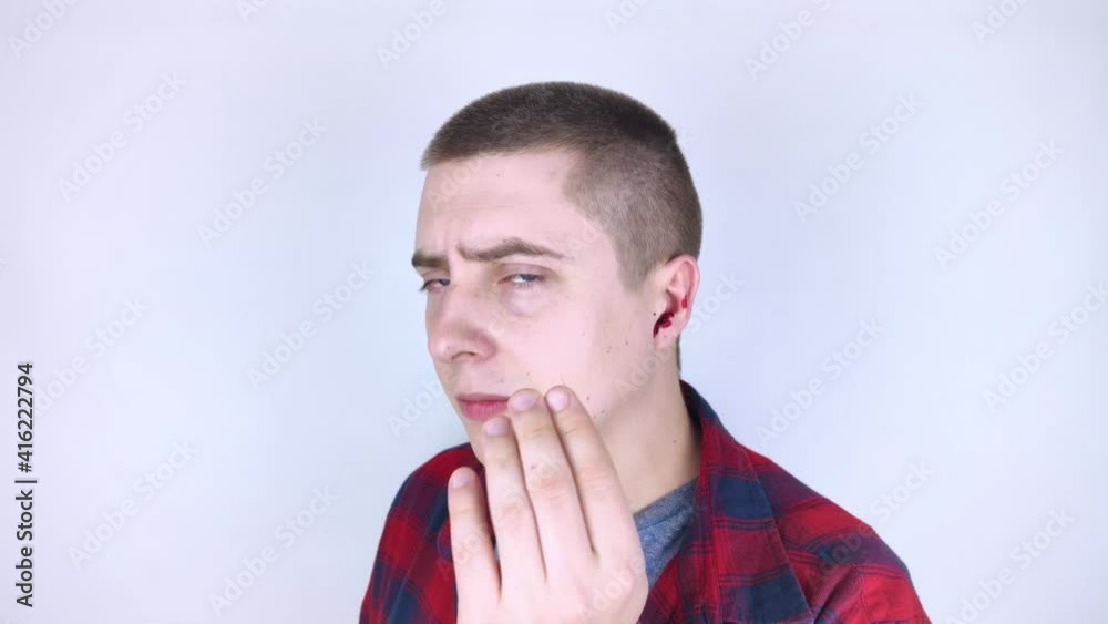 A man whose ear is bleeding. Vascular rupture, damage to the tympanic ...