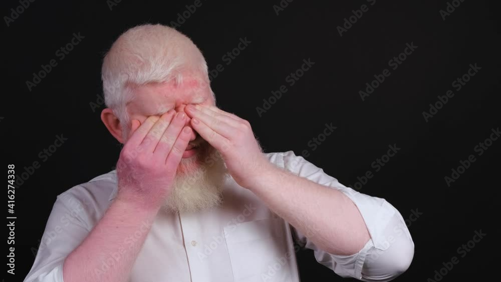 Man with albinism isolated on a black background raises his hand to ...