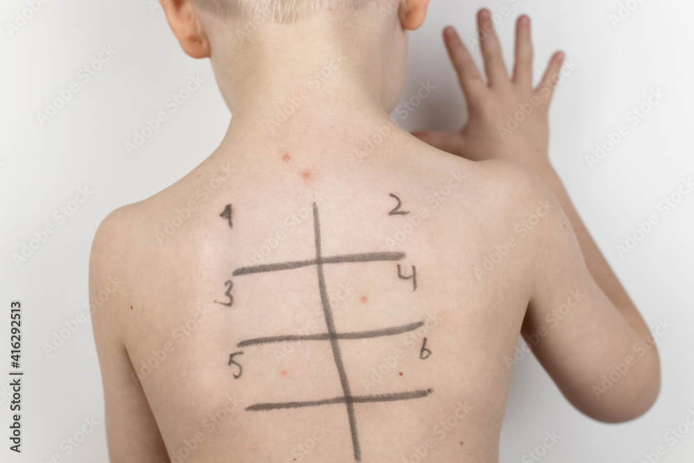 Fotografia do Stock: An allergist in the laboratory conducts an allergy ...