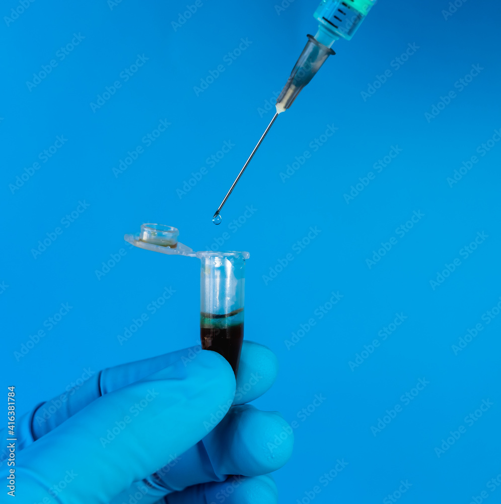 Vertical close-up of a microcentrifuge tube with a blood sample, and on ...