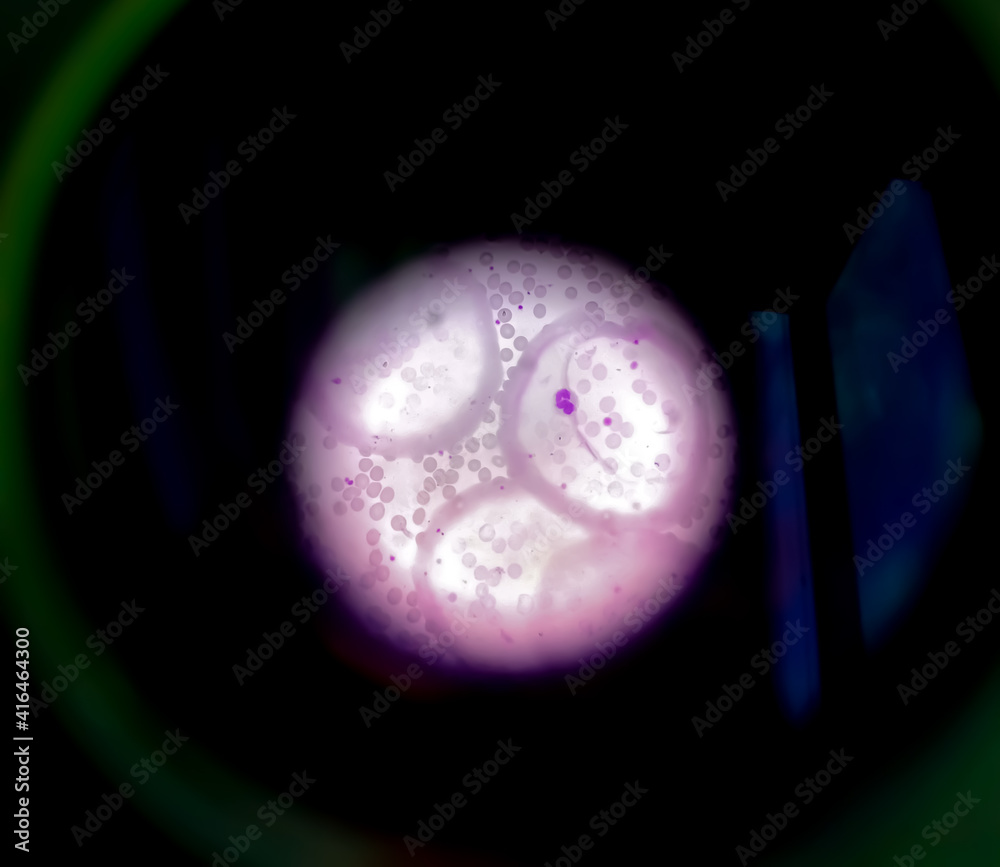 Microscopic view of hematology slide. RBC. WBC. closeup. Stained slide ...