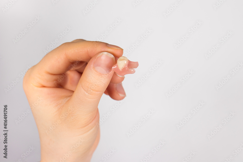 Artificial tooth prosthesis in a person's hand. Single removable ...