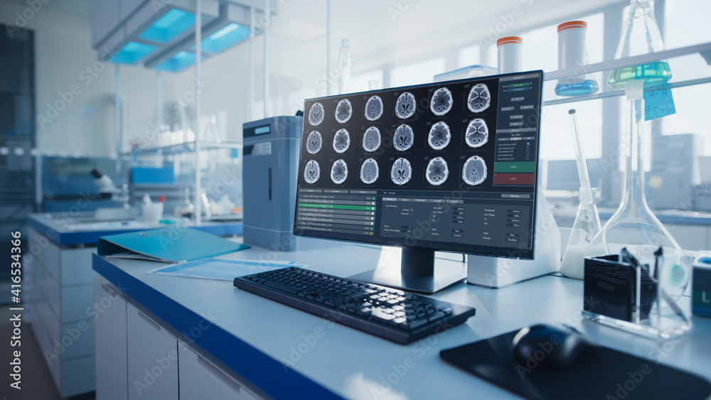 Modern Medical Research Laboratory with Computer Showing MRI Brain ...
