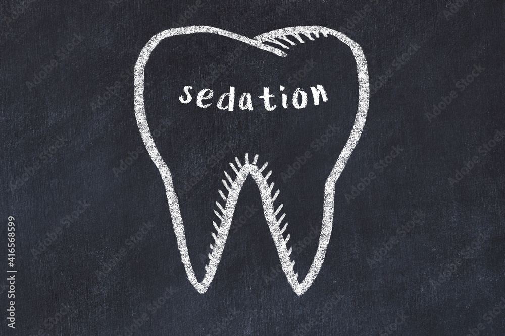 Chalk drawing of a tooth with medical term sedation. Concept of ...