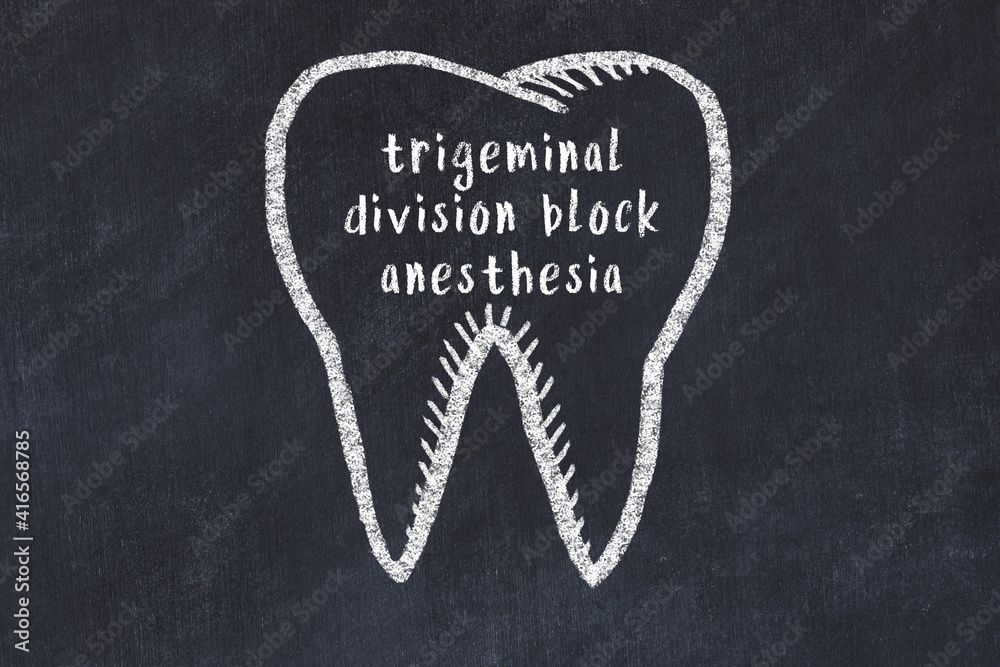 Chalk drawing of a tooth with medical term trigeminal division block ...