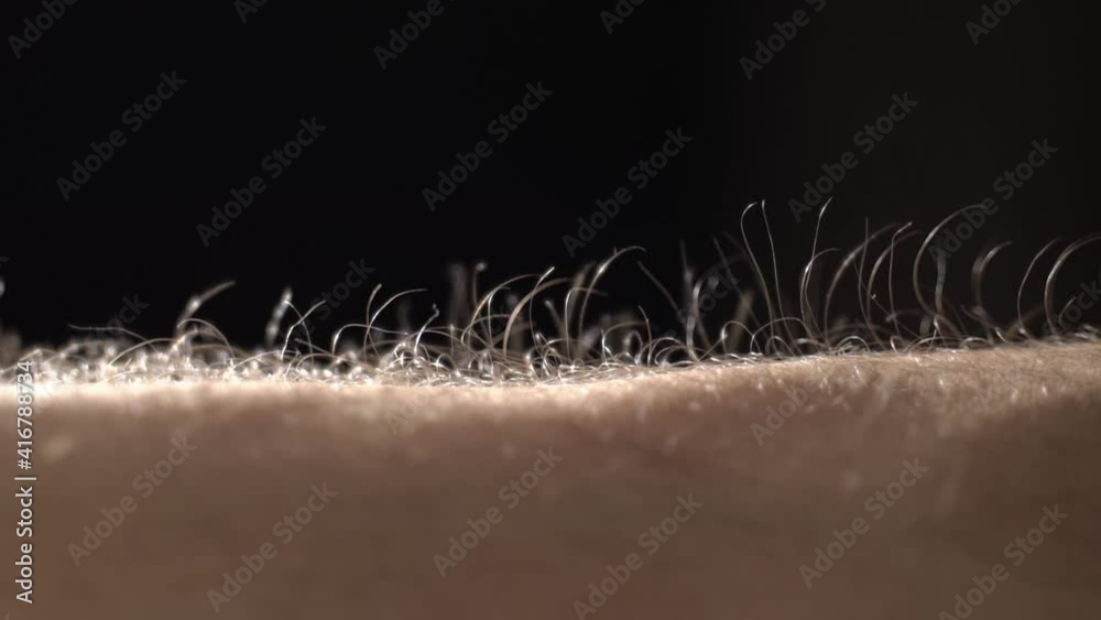 Goosebumps close up. Hair on his hand stand up. Static electricity ...