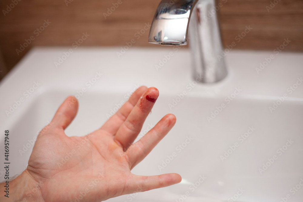 The man cut his finger. A cut. Blood flows from the finger Stock Photo ...
