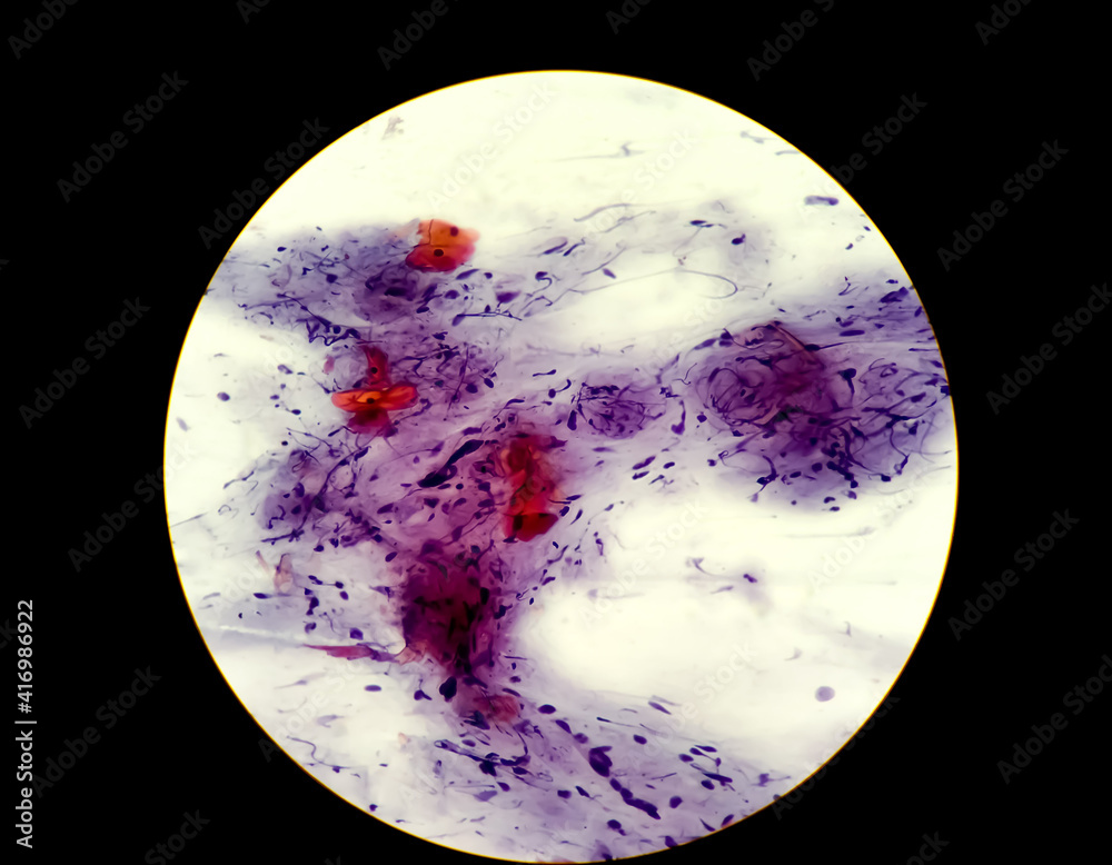 Human Cheek Epithelial Cells. The tissue that lines the inside of the ...