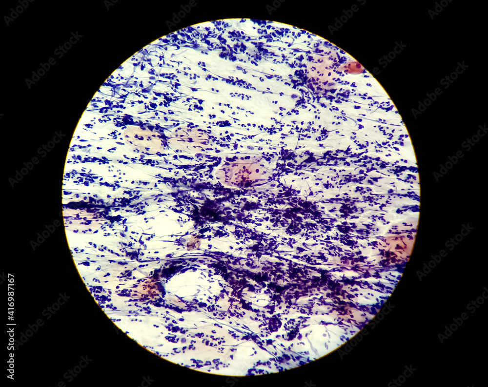 Human Cheek Epithelial Cells. The tissue that lines the inside of the ...