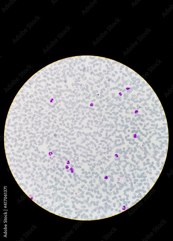 Human peripheral blood smear under 40x light microscope present ...