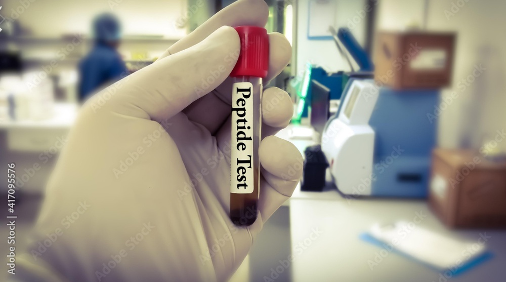 Liver figure, test tubes with blood, liver function test result are ...