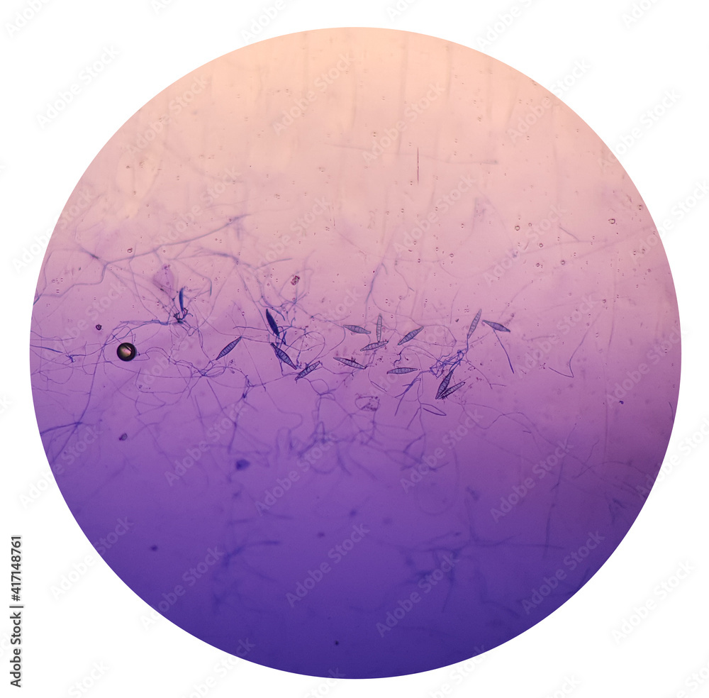 Microscopic finding shows macroconidia of Microsporum canis in dog with ...