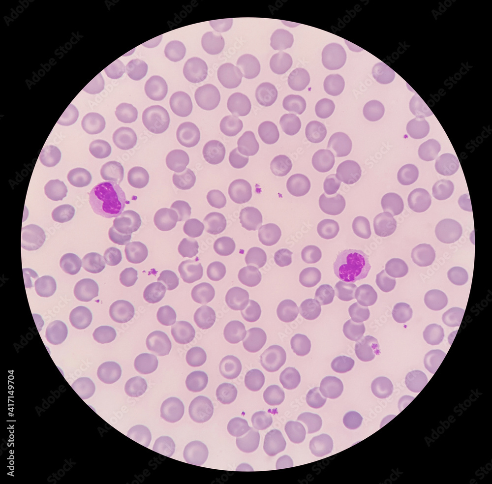 Under microscopic of elephant blood film showed red blood cell ...