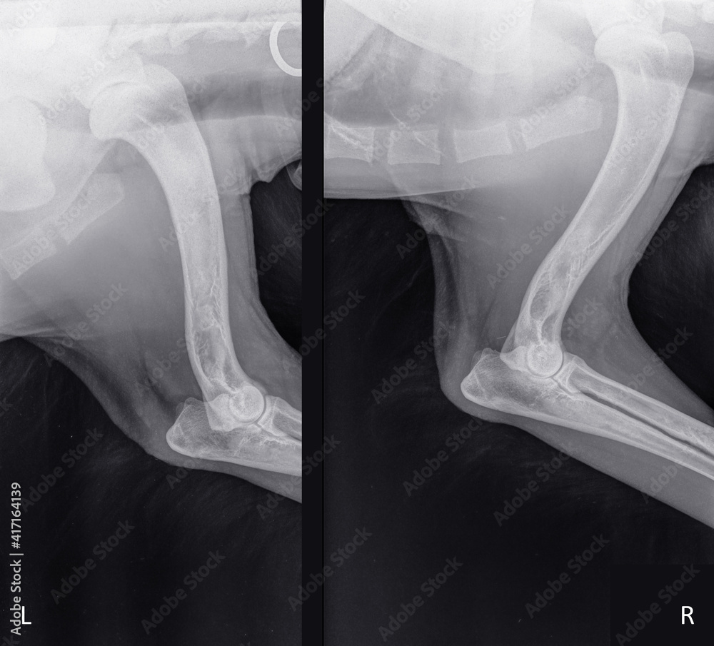 X-ray of the front leg (Left and Right) of a young dog with enostosis ...