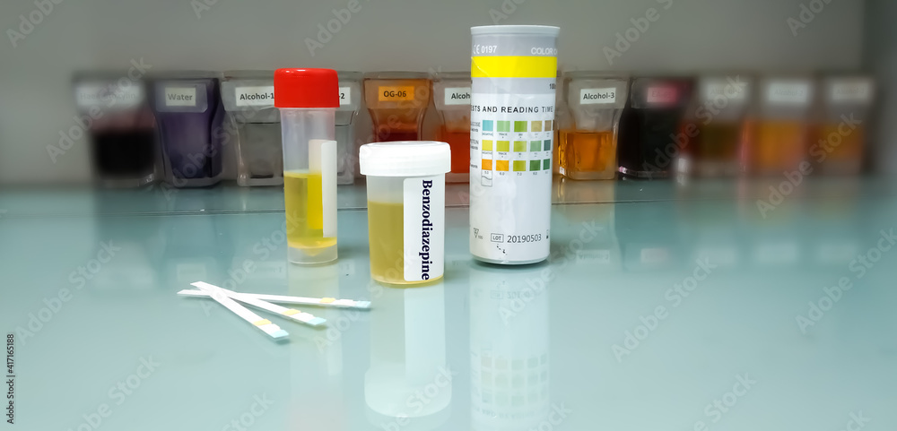 Medical laboratory container with urine sample rests on drugs test ...