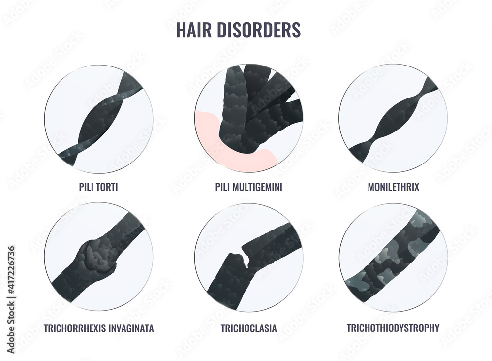 Damaged Hair Under Microscope