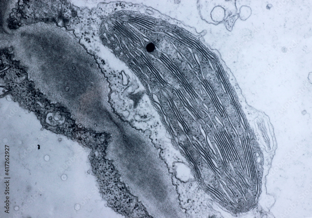 A ultrathin section of plant leaf mesophyll cells showing chloroplast ...