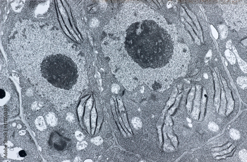 Electron microscopy of a vegetal cell showing chloroplast, nucleus ...