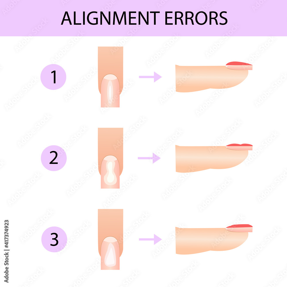 Alignment of the nail plate. Professional manicure guide, Vector ...