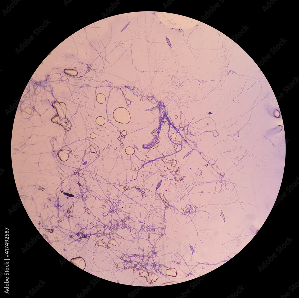 Microsporum Canis Dog